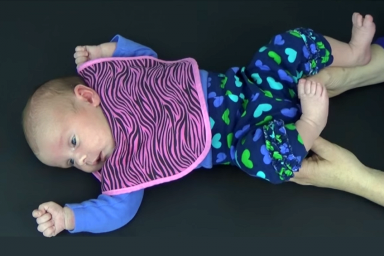 What To Do If Your Infant Has Torticollis? - Cranial Therapy Centers
