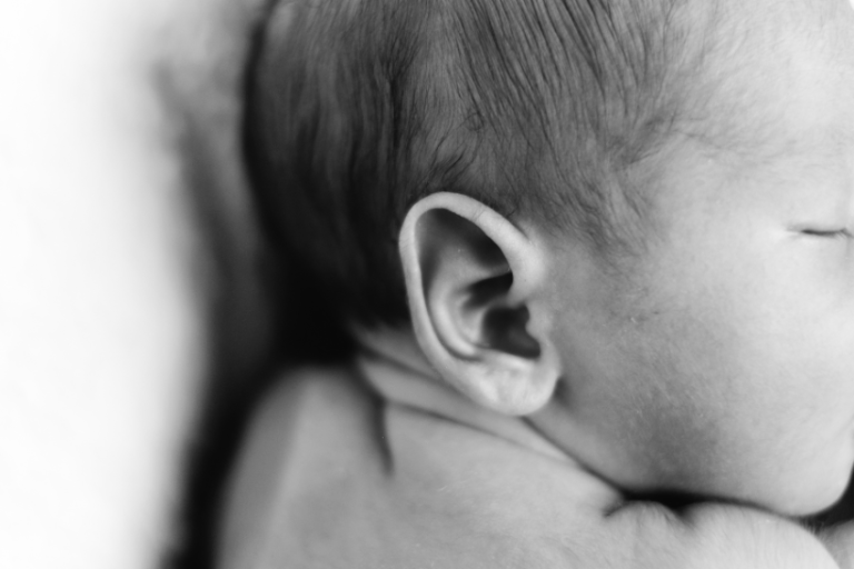 How To Help a Baby With Torticollis? - Cranial Therapy Centers